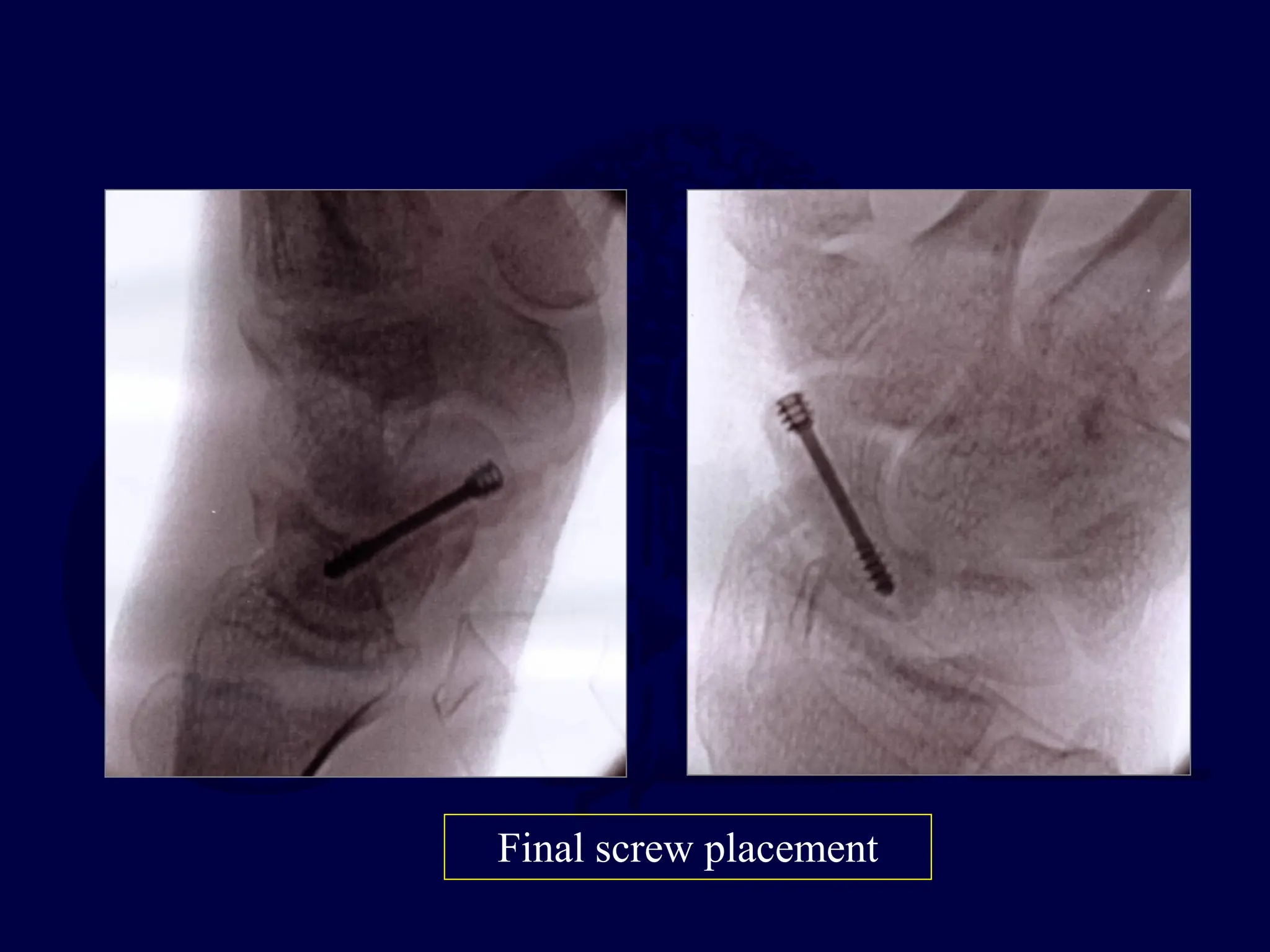 Carpal Fractures and Dislocations.....pdf