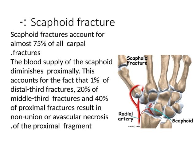 Carpal bones injuries نذير العزعزي.pptx