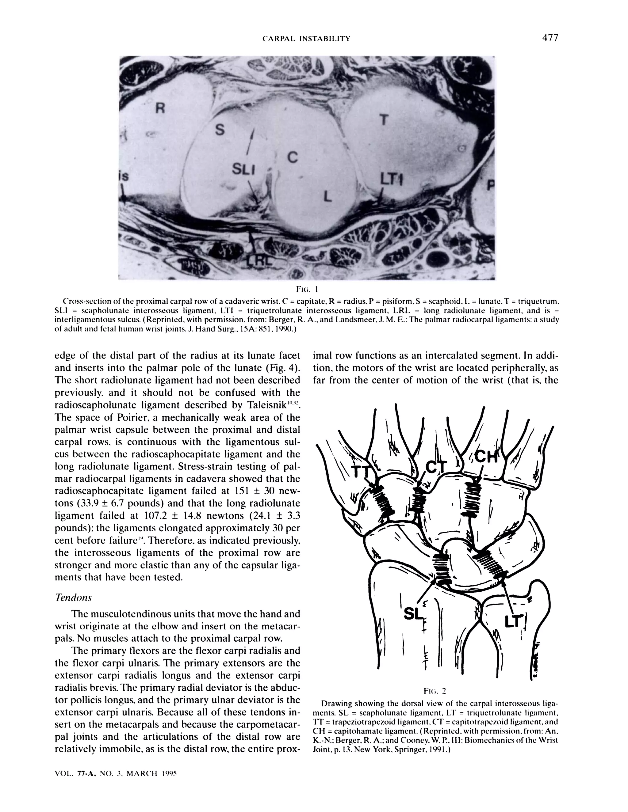 Carpal instability | PDF