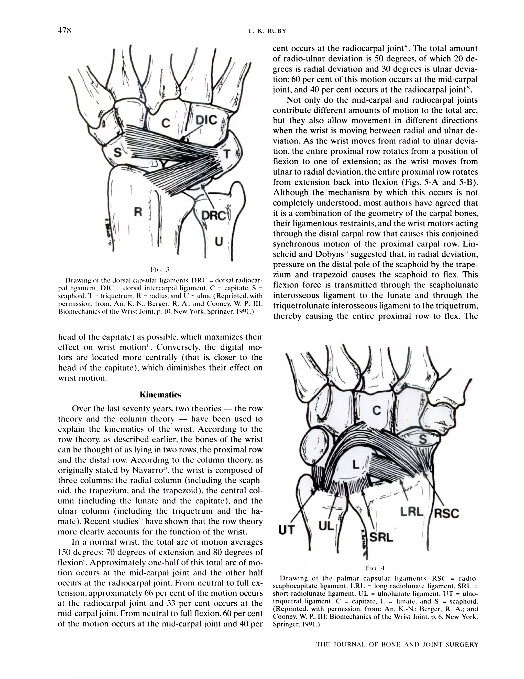 Carpal instability | PDF