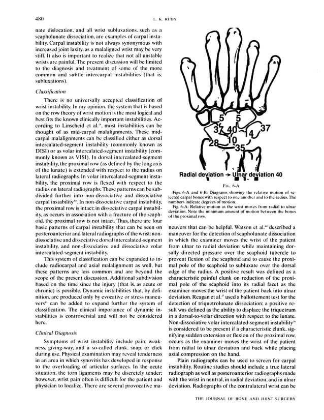 Carpal instability | PDF