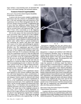Carpal instability | PDF