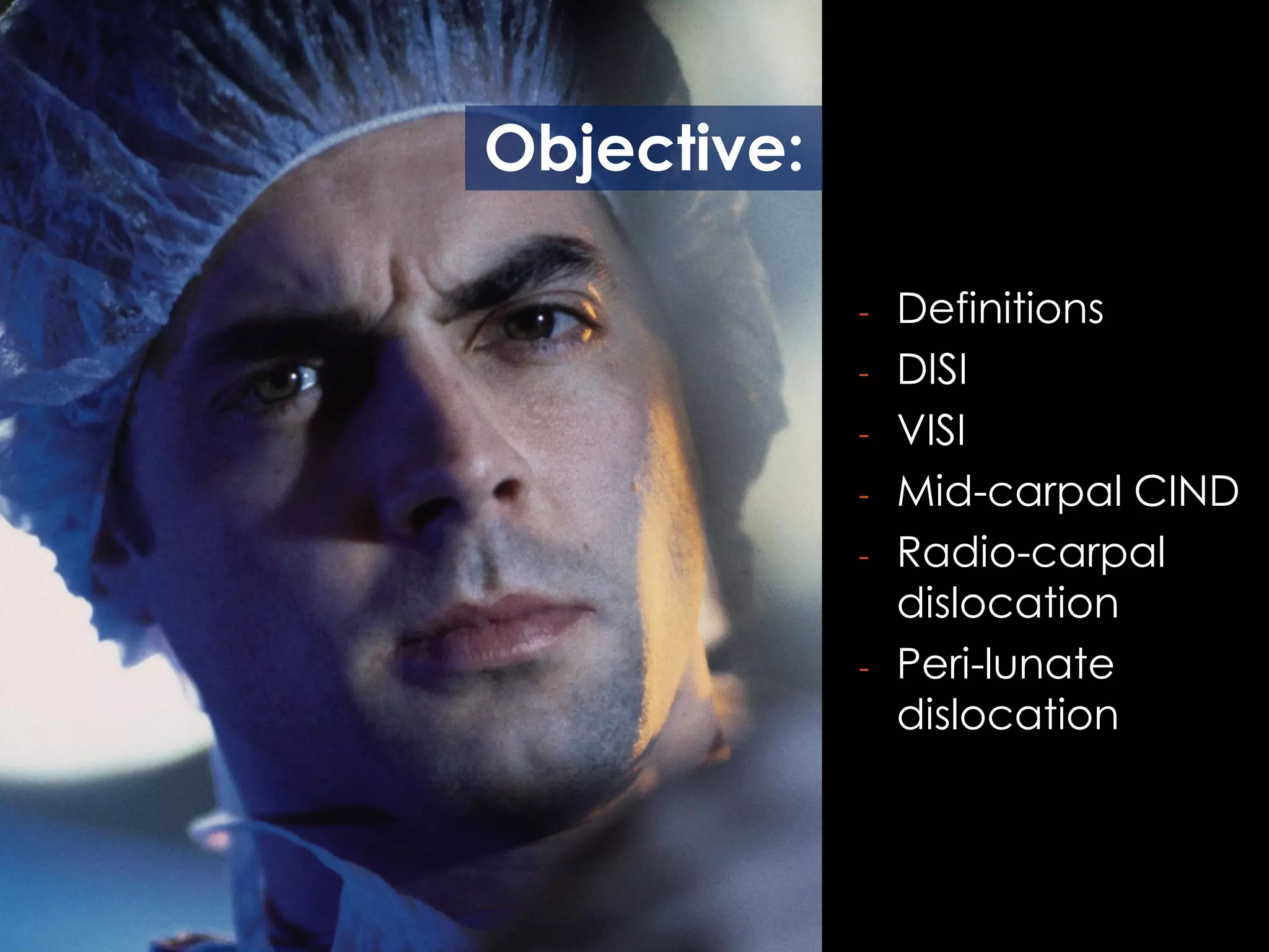 Carpal instability - Orthopedic | PDF