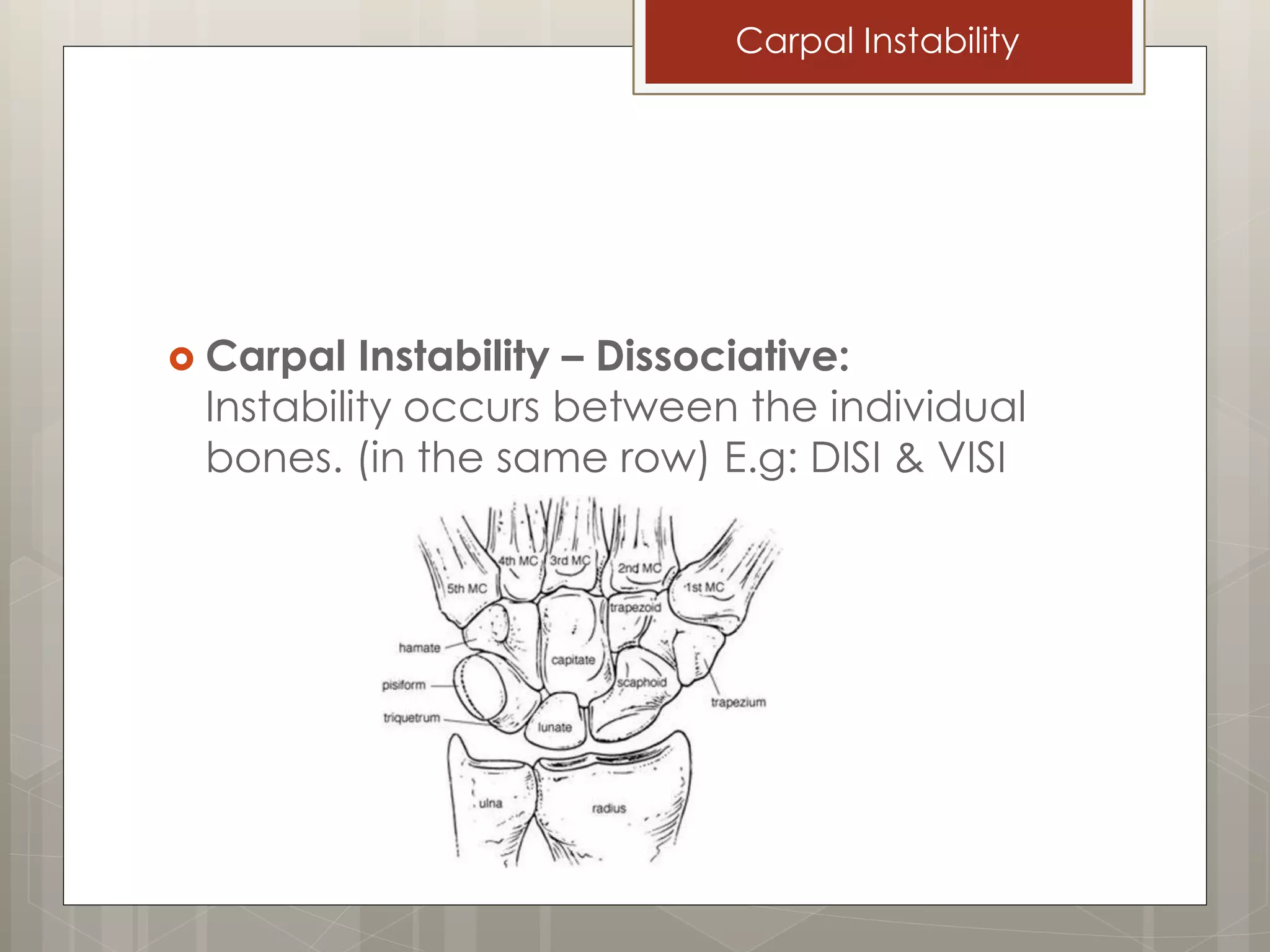 Carpal instability - Orthopedic | PDF