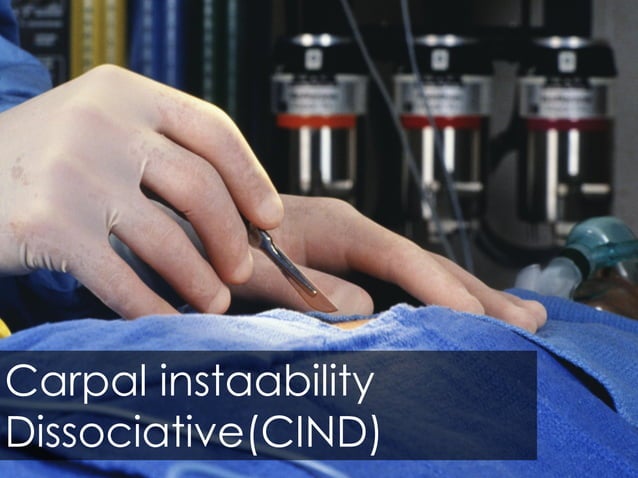 Carpal instability - Orthopedic | PDF