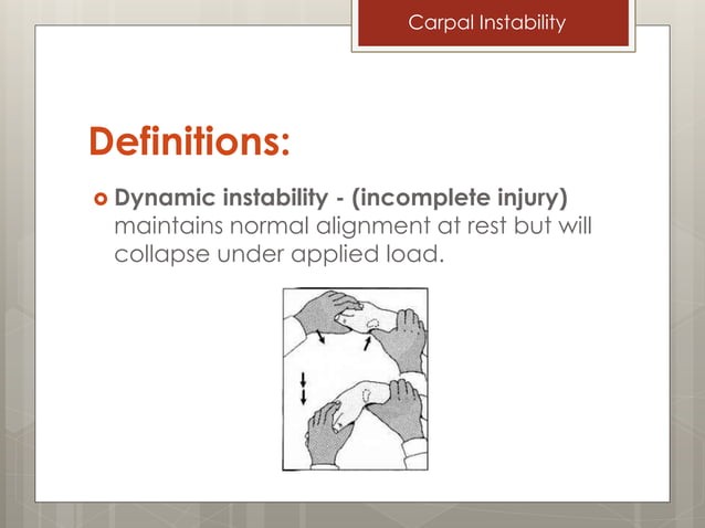 Carpal instability - Orthopedic | PDF