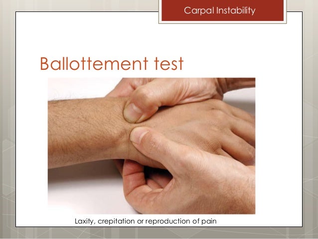 Carpal instability - Orthopedic