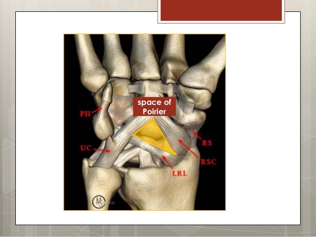 Carpal instability - Orthopedic