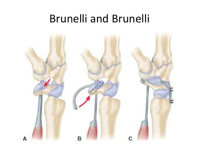 How To Share A Test In Blackboard