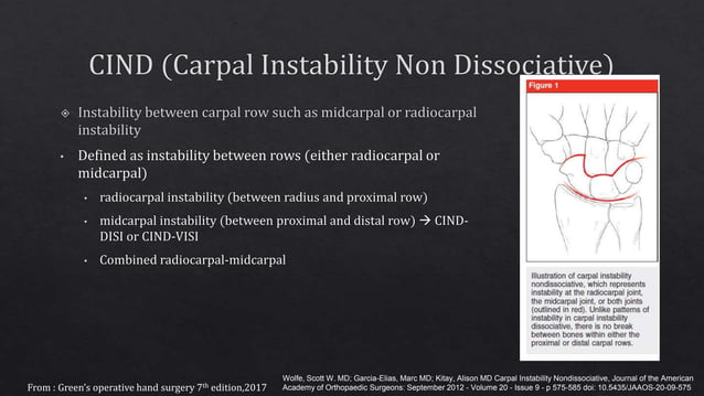Carpal instability | PPTX
