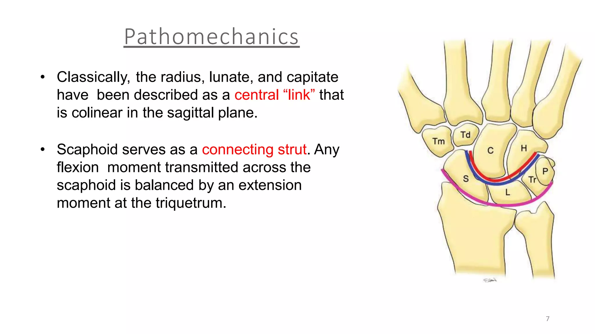 carpal instability & management.pptx