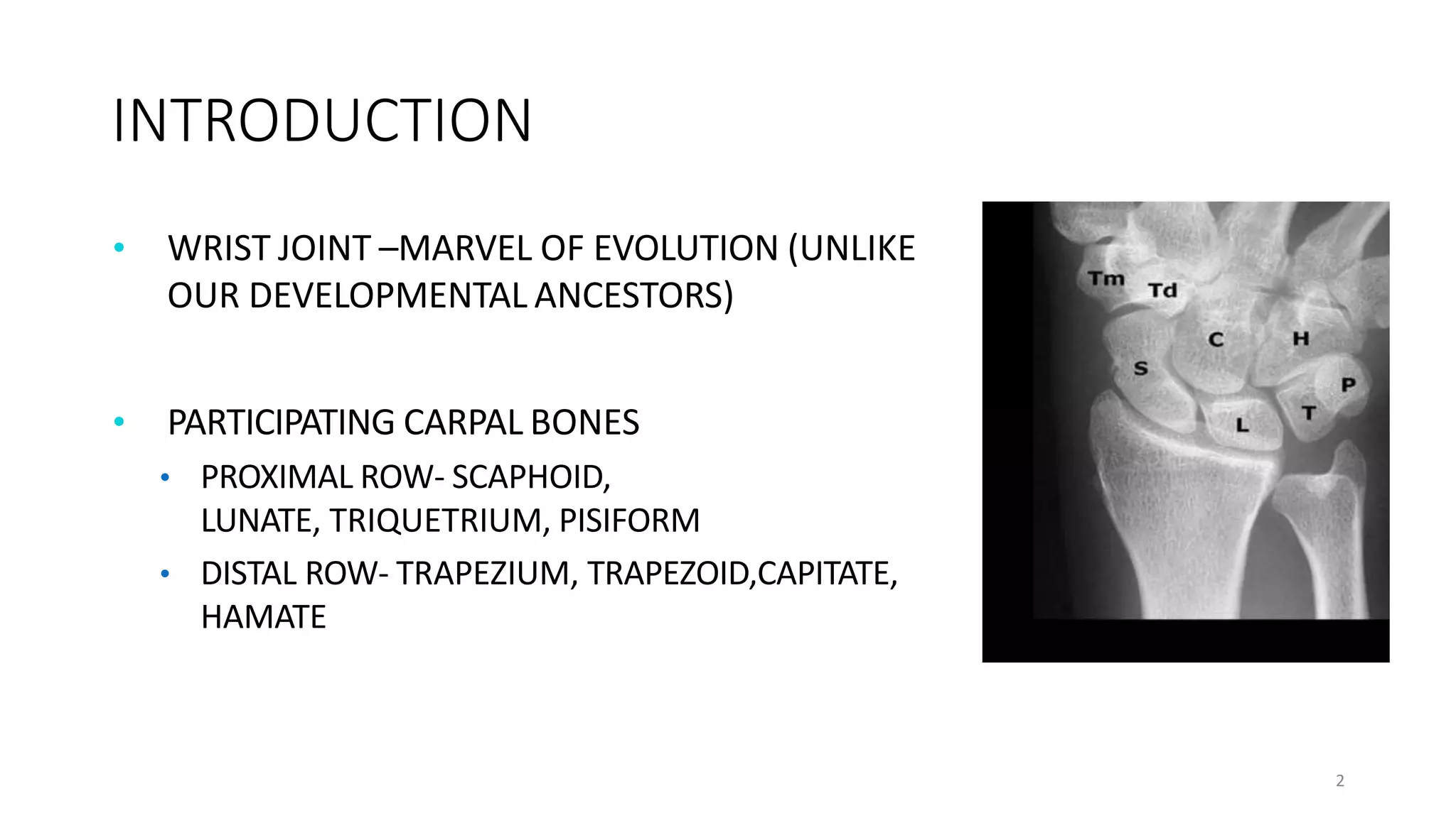 carpal instability & management.pptx