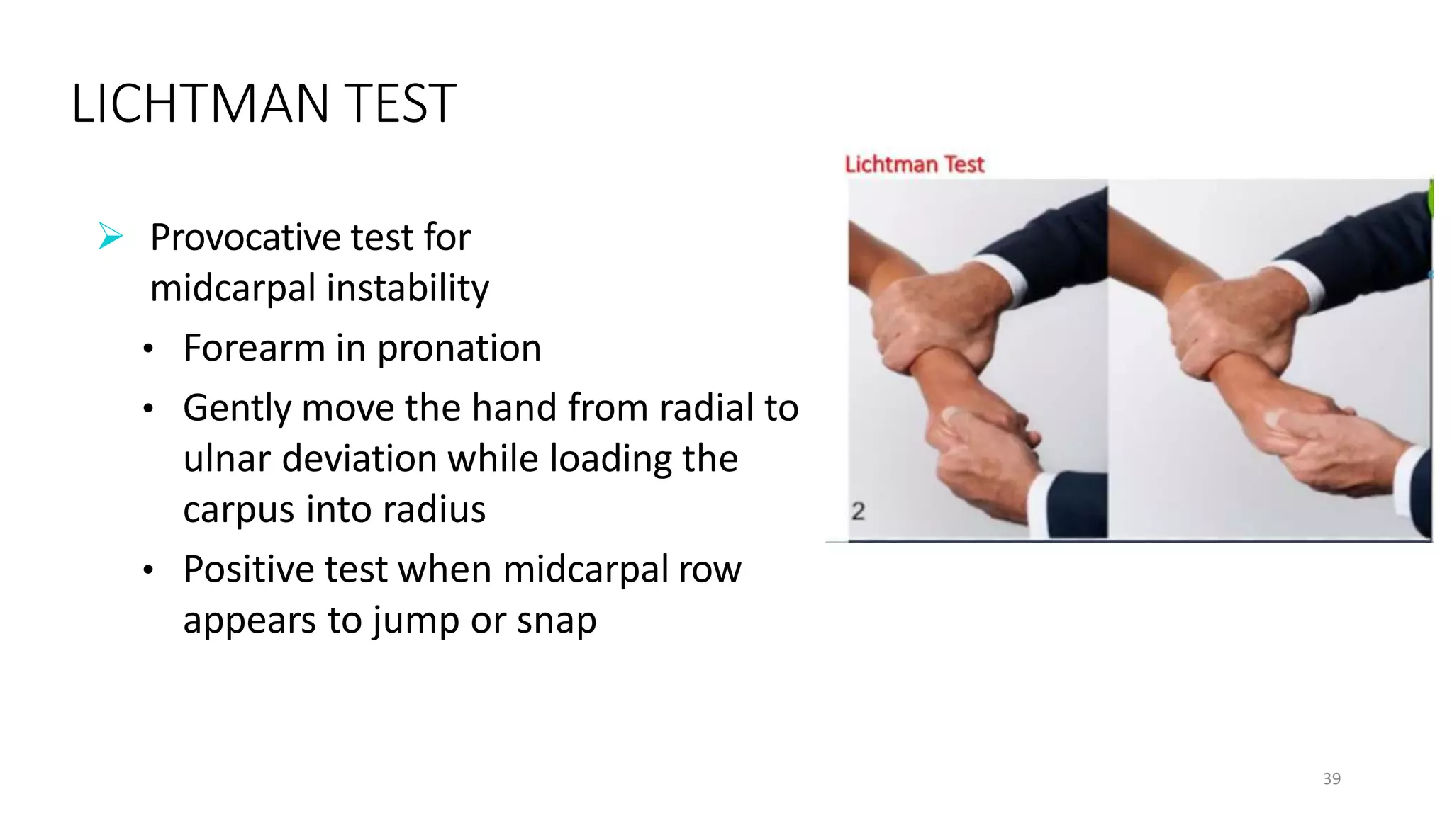 carpal instability & management.pptx