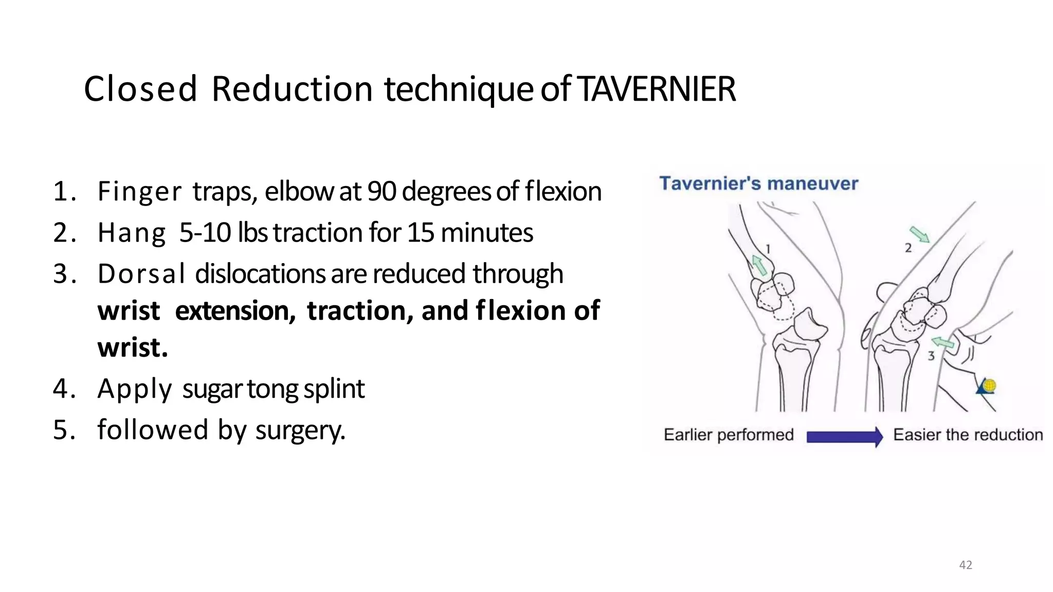 carpal instability & management.pptx