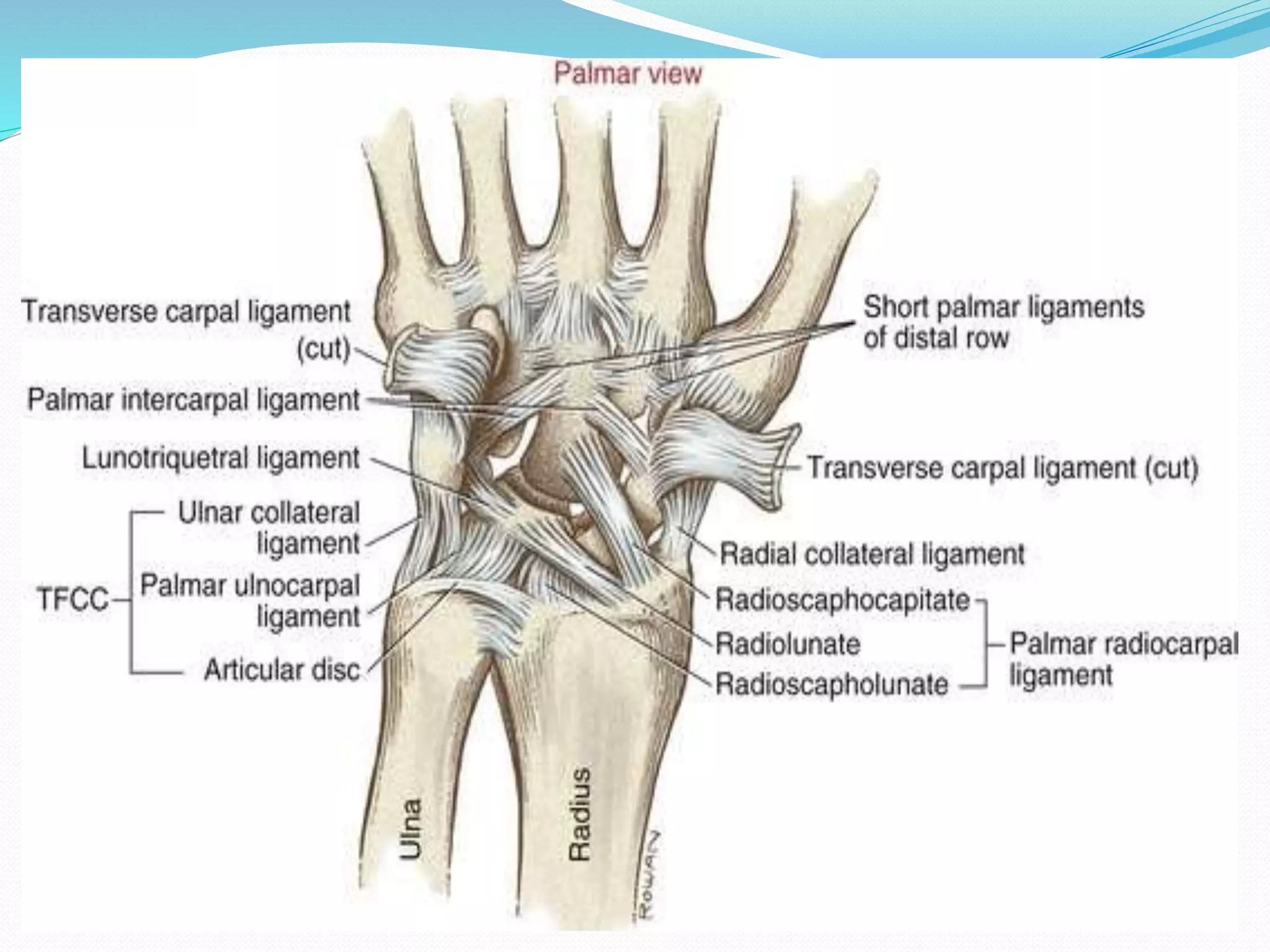 Carpal instability and perilunate dislocation | PPTX
