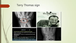 Carpal instability by dr Humayun.pptx