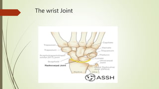 Carpal instability by dr Humayun.pptx