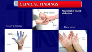 Carpal tunnel Syndrom, CTS | PPTX