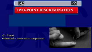 Carpal tunnel Syndrom, CTS | PPTX