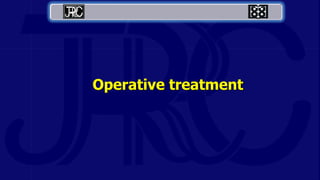 Carpal tunnel Syndrom, CTS | PPTX