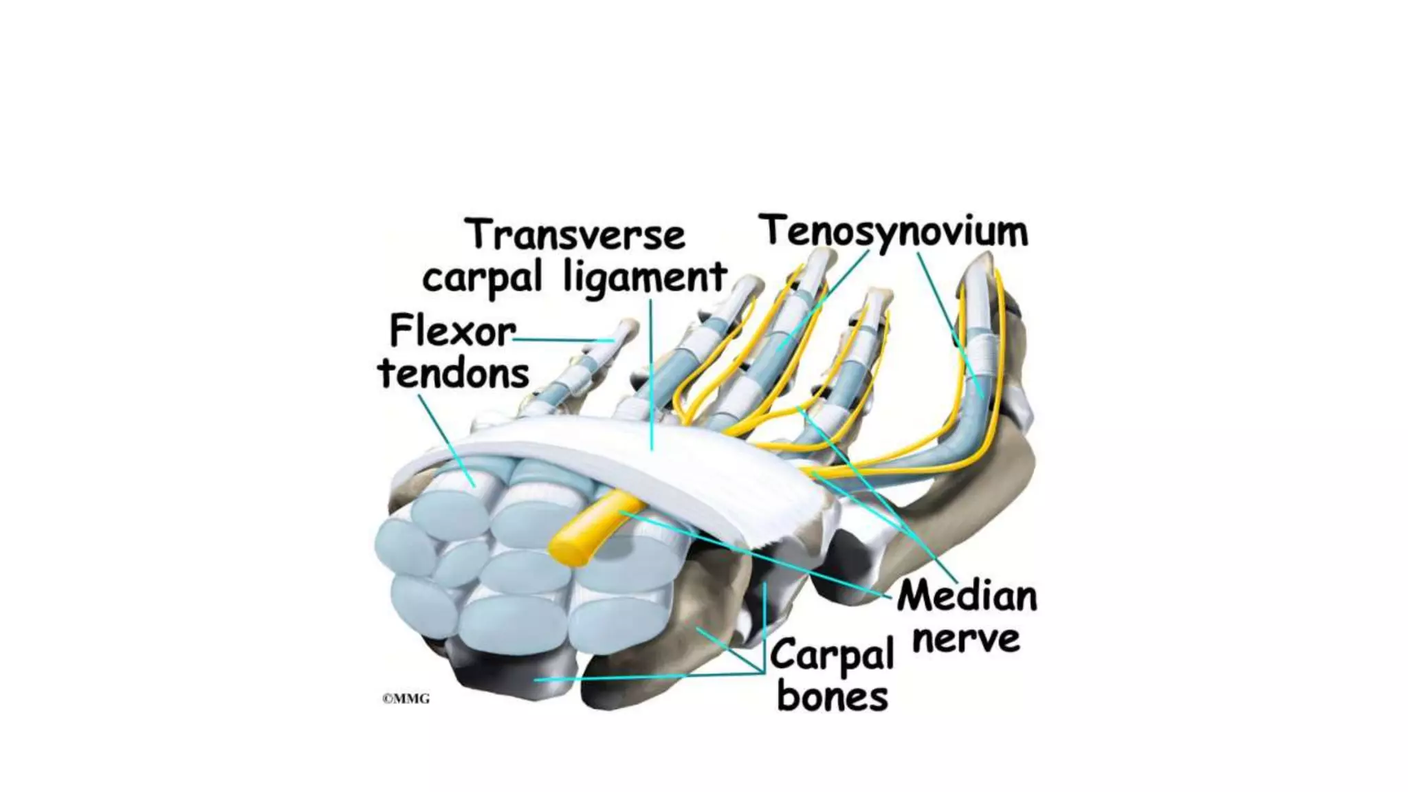 Carpal Tunnel Release | PPTX