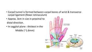 Carpal Tunnel Release | PPTX