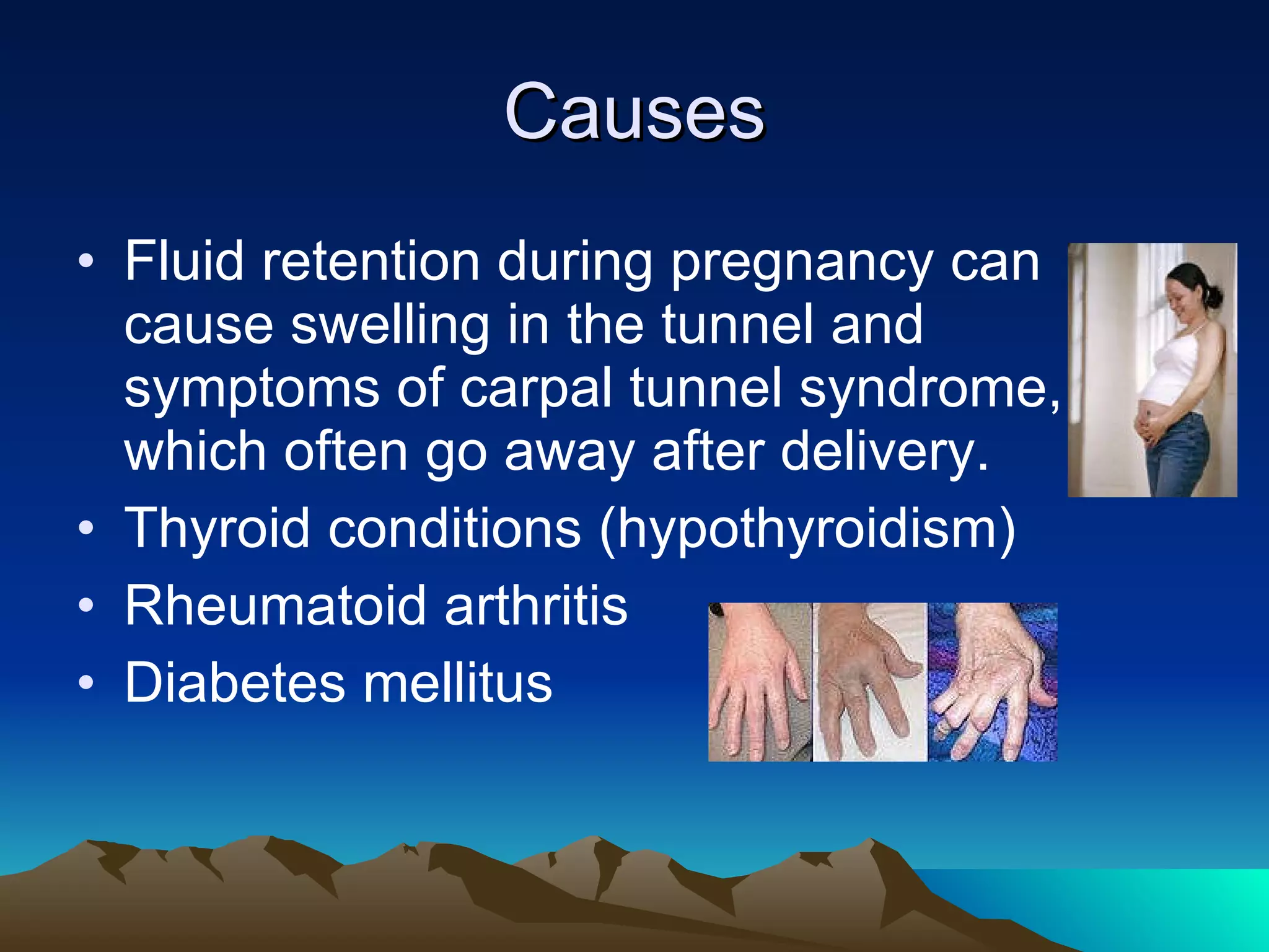 Carpal tunnel syndrome | PPT