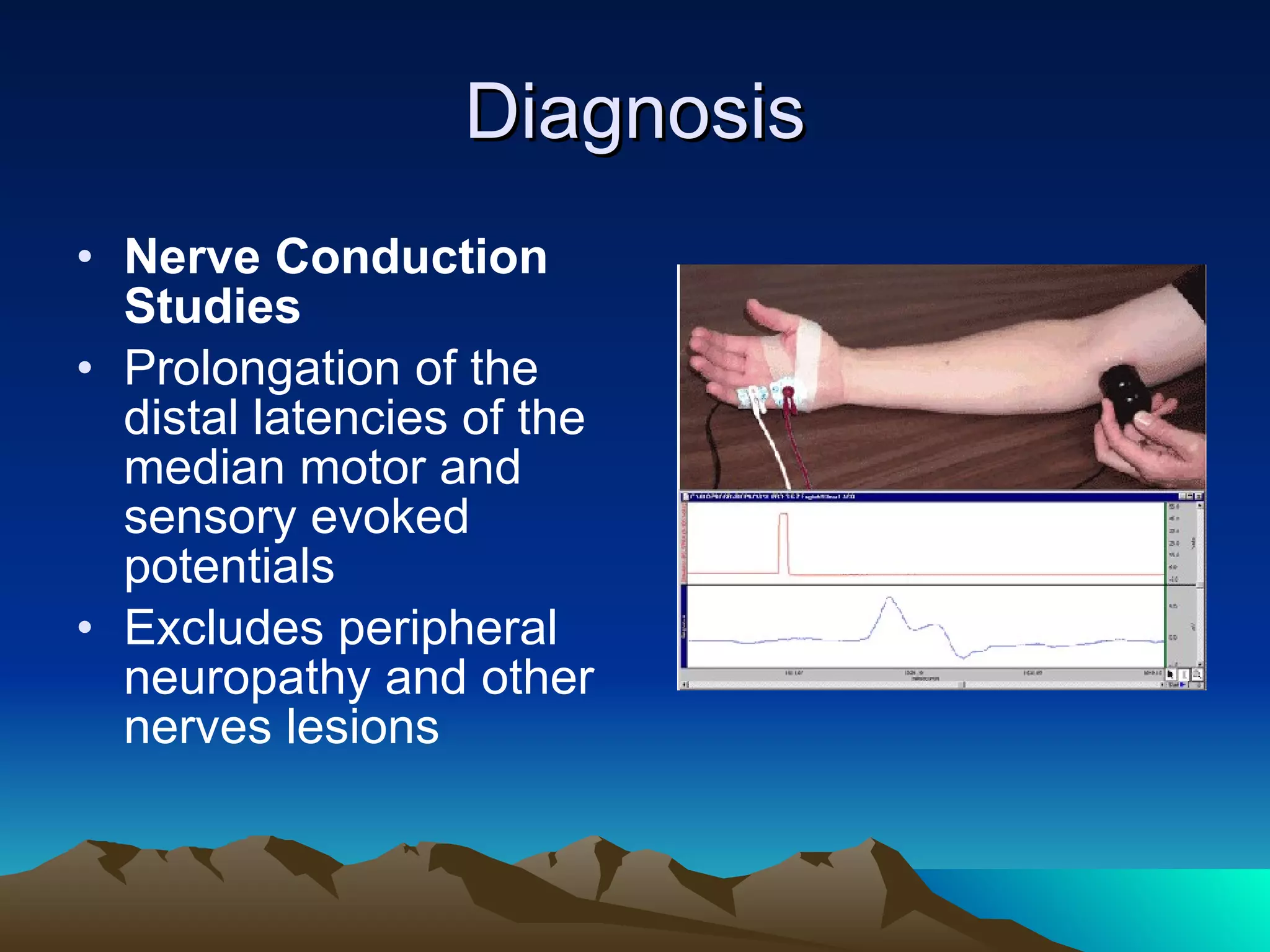 Carpal tunnel syndrome | PPT