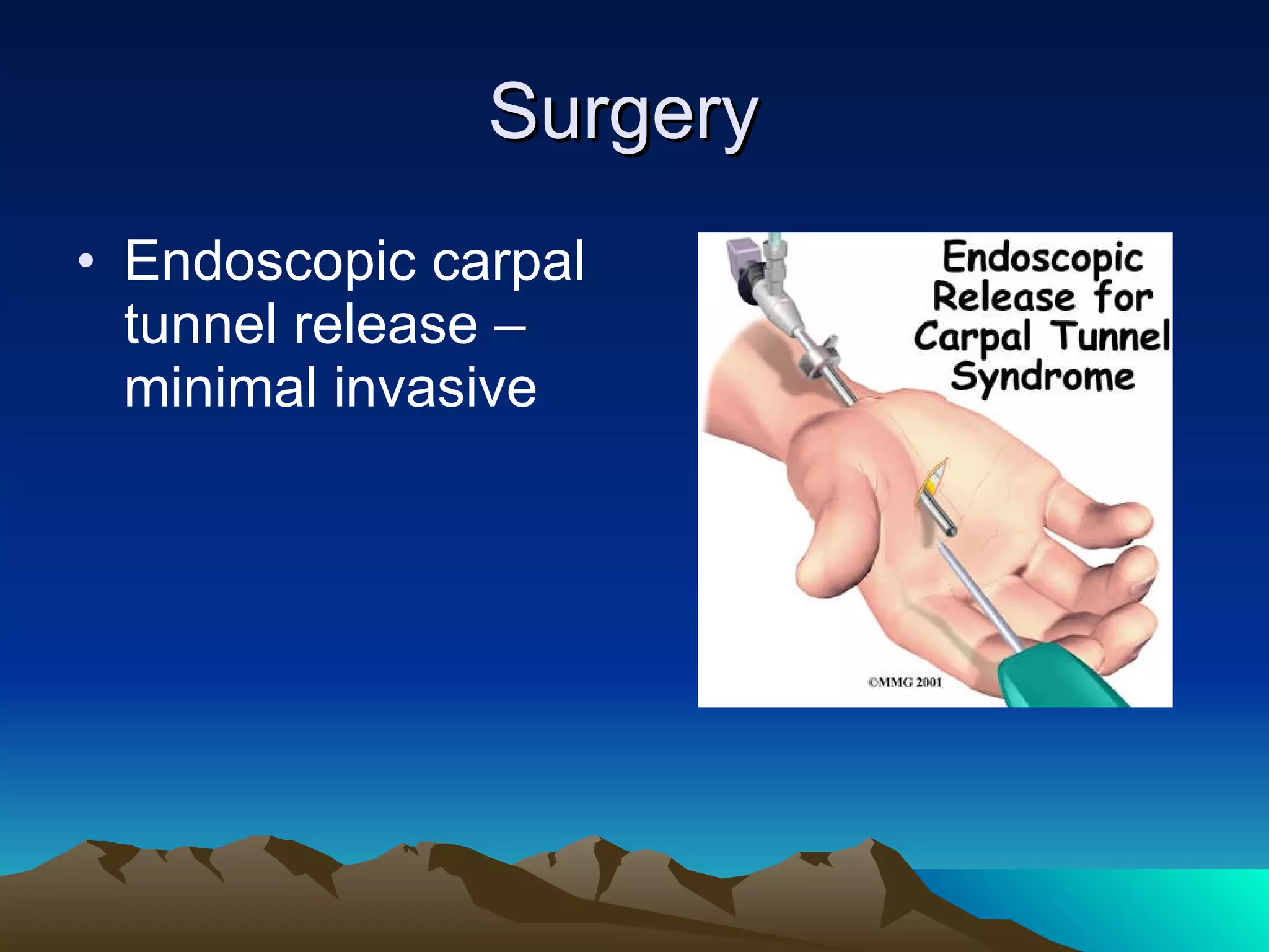 Carpal tunnel syndrome | PPT