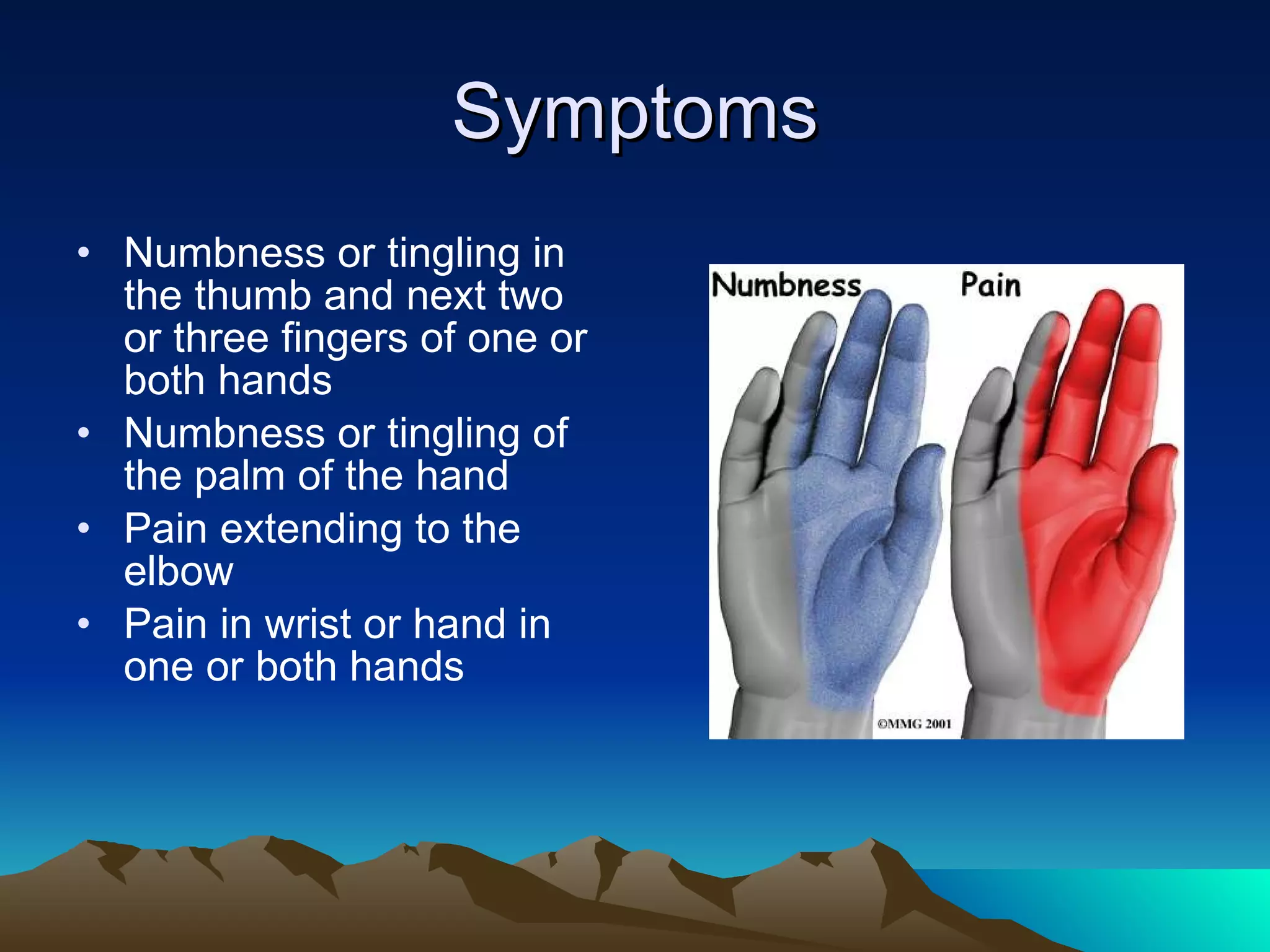 Carpal tunnel syndrome | PPT