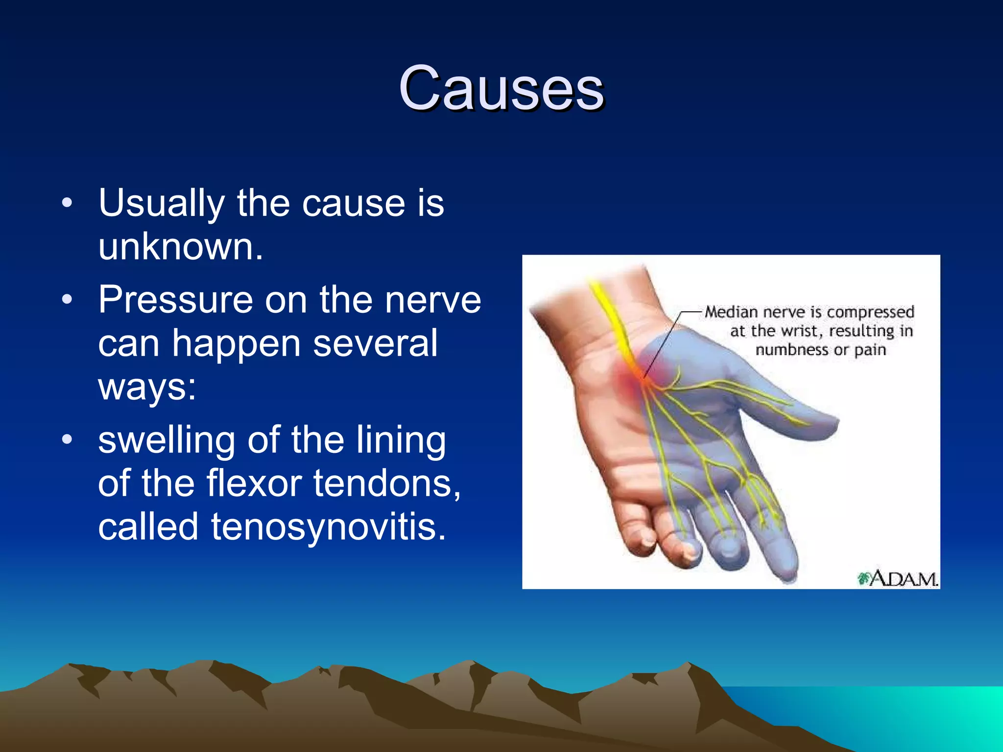 Carpal tunnel syndrome | PPT