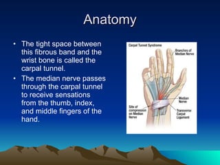 Carpal tunnel syndrome | PPT
