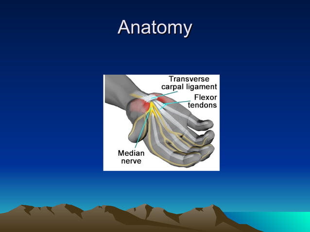 Carpal tunnel syndrome | PPT