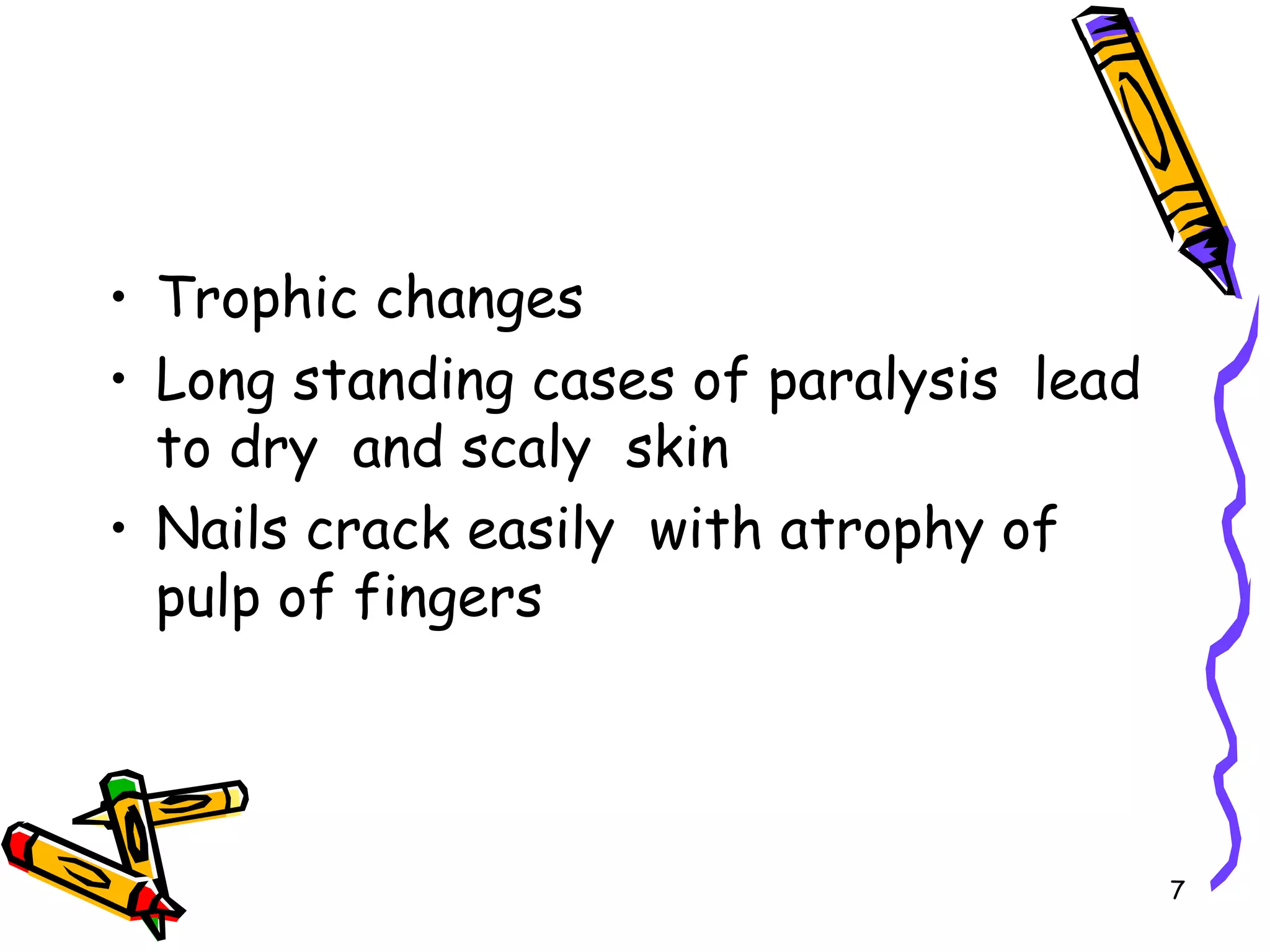 Carpal tunnel syndrome | PPT