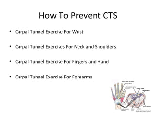 Carpal tunnel syndrome. | PPT
