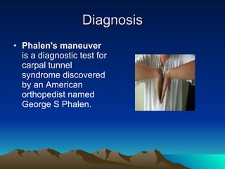 Carpal Tunnel Syndrome | PPT