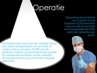 Carpaal tunnel syndrome | PDF