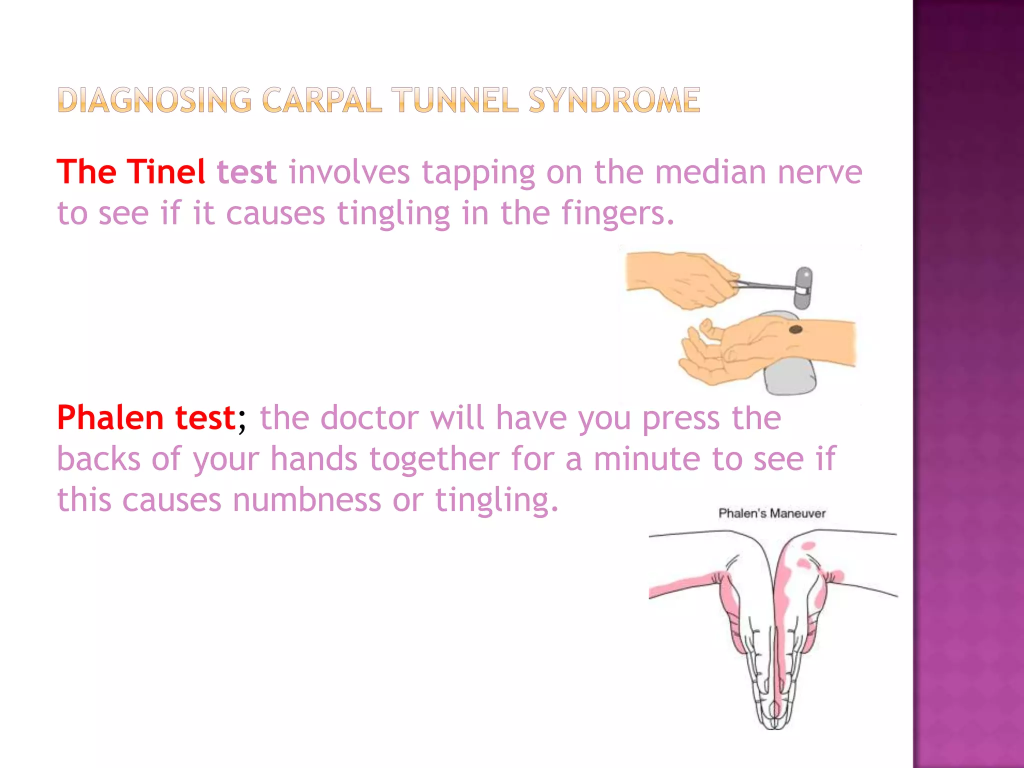 Carpal tunnel syndrome CTS 2014 | PPTX