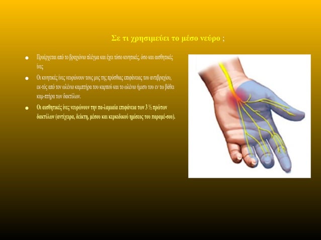 Carpal tunnel syndrome | PPT