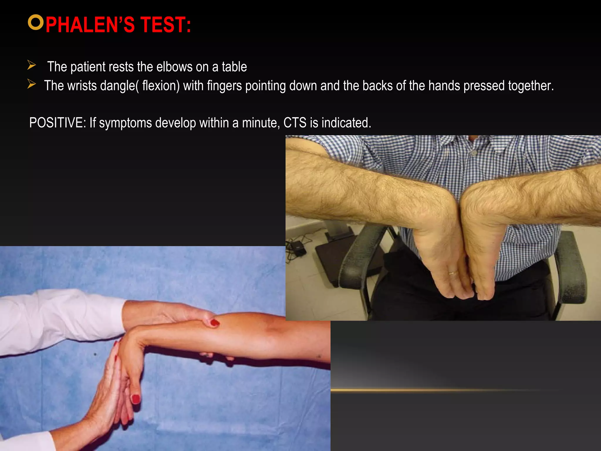 Carpal tunnel syndrome | PPT