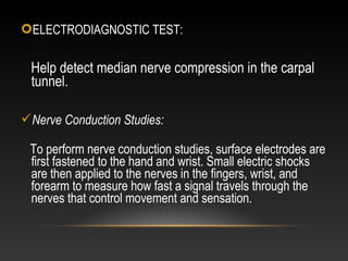 Carpal tunnel syndrome | PPT