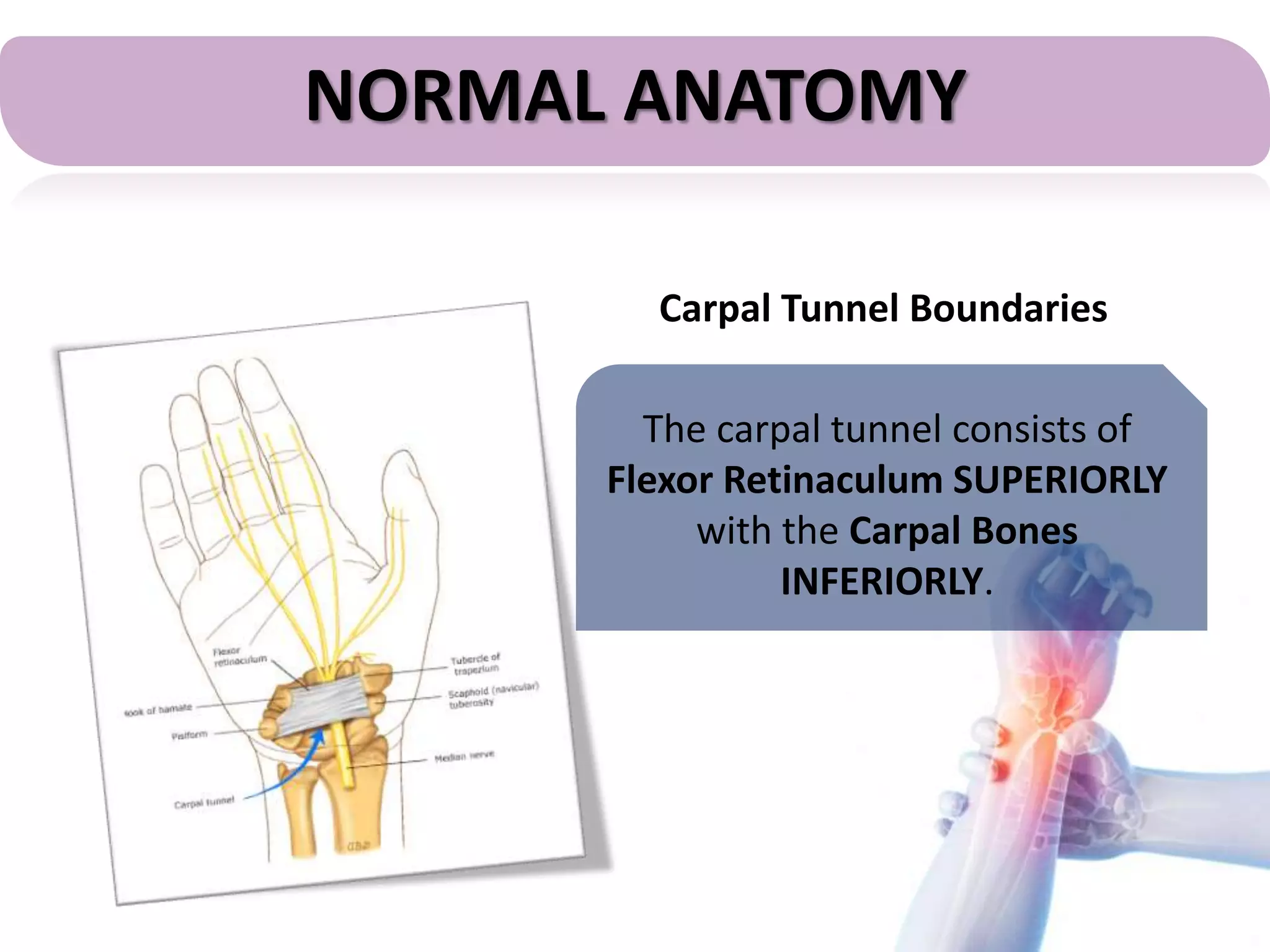 Carpal Tunnel Syndrome | PPTX