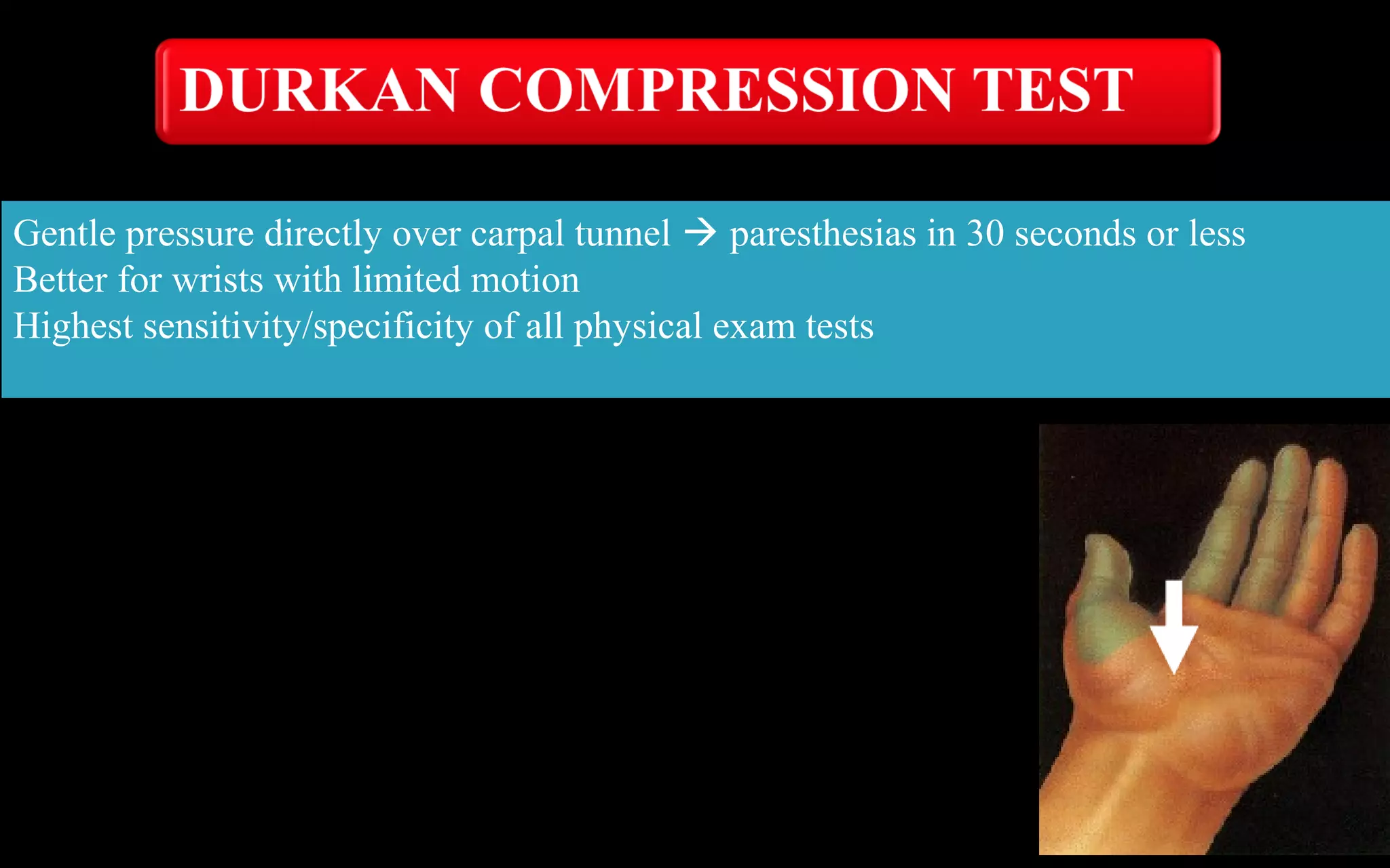 Carpal tunnel syndrome | PPT