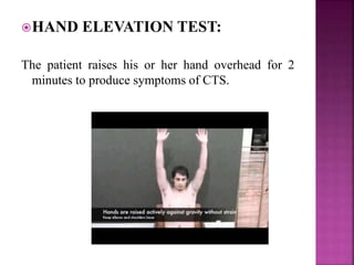 Carpal tunnel syndrome @ | PPTX