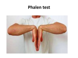 Carpal tunnel syndrome | PPTX