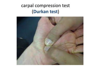 Carpal tunnel syndrome | PPTX