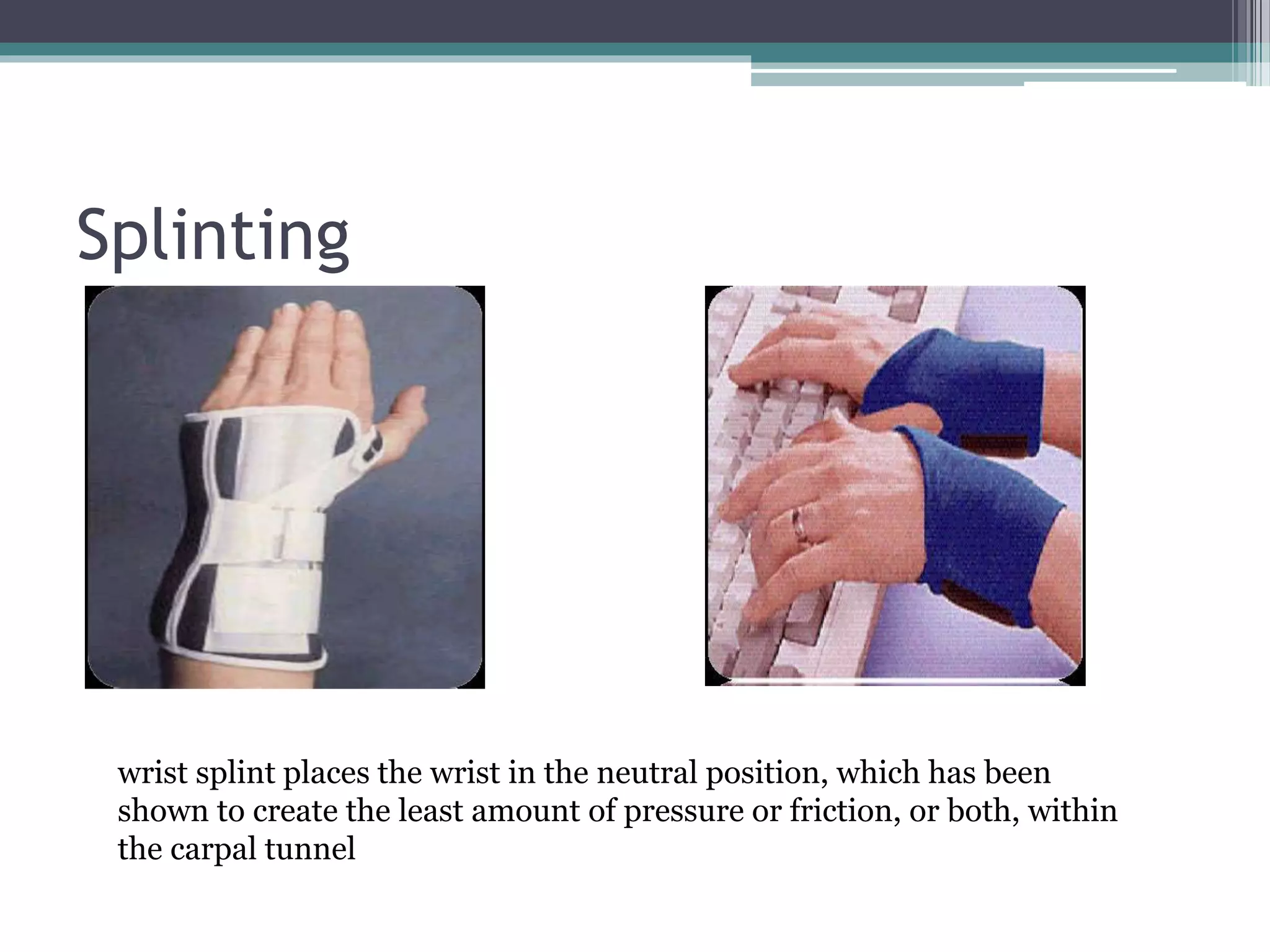 Carpal Tunnel Syndrome | PPTX