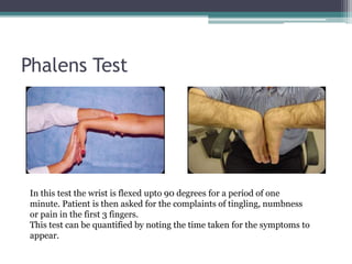 Carpal Tunnel Syndrome | PPTX