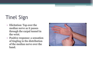 Carpal Tunnel Syndrome | PPTX