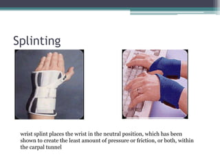 Carpal Tunnel Syndrome | PPTX